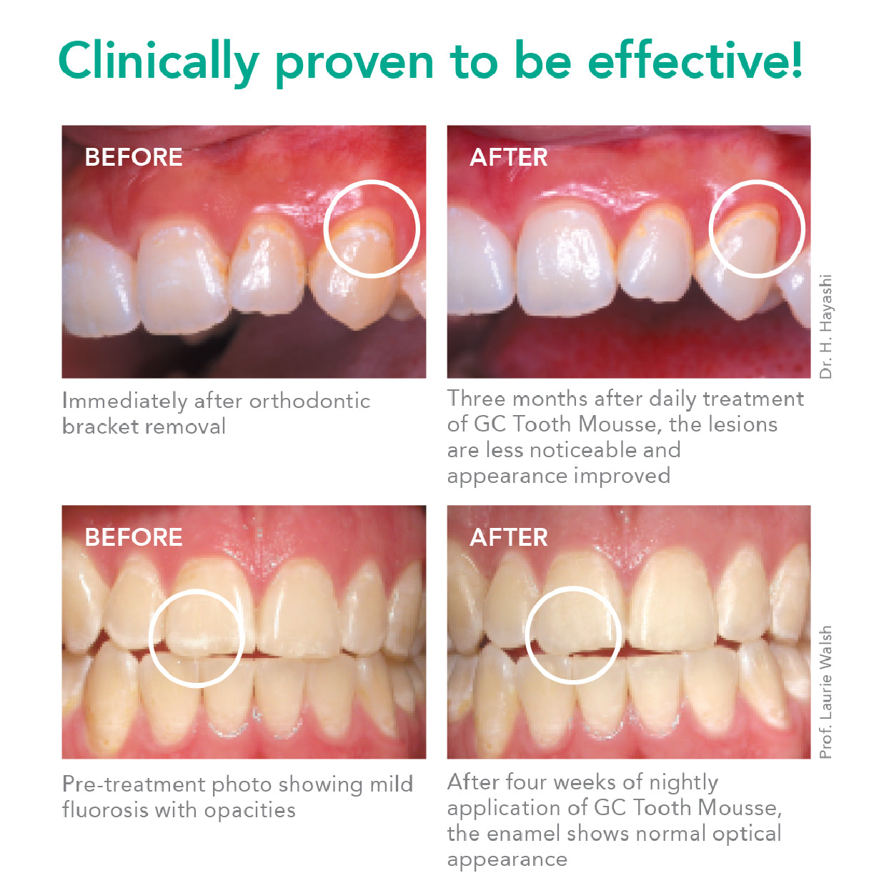 GC TOOTH MOUSSE PLUS WITH EXTRA MILK PROTEIN ASSORTED FLAVORS ...